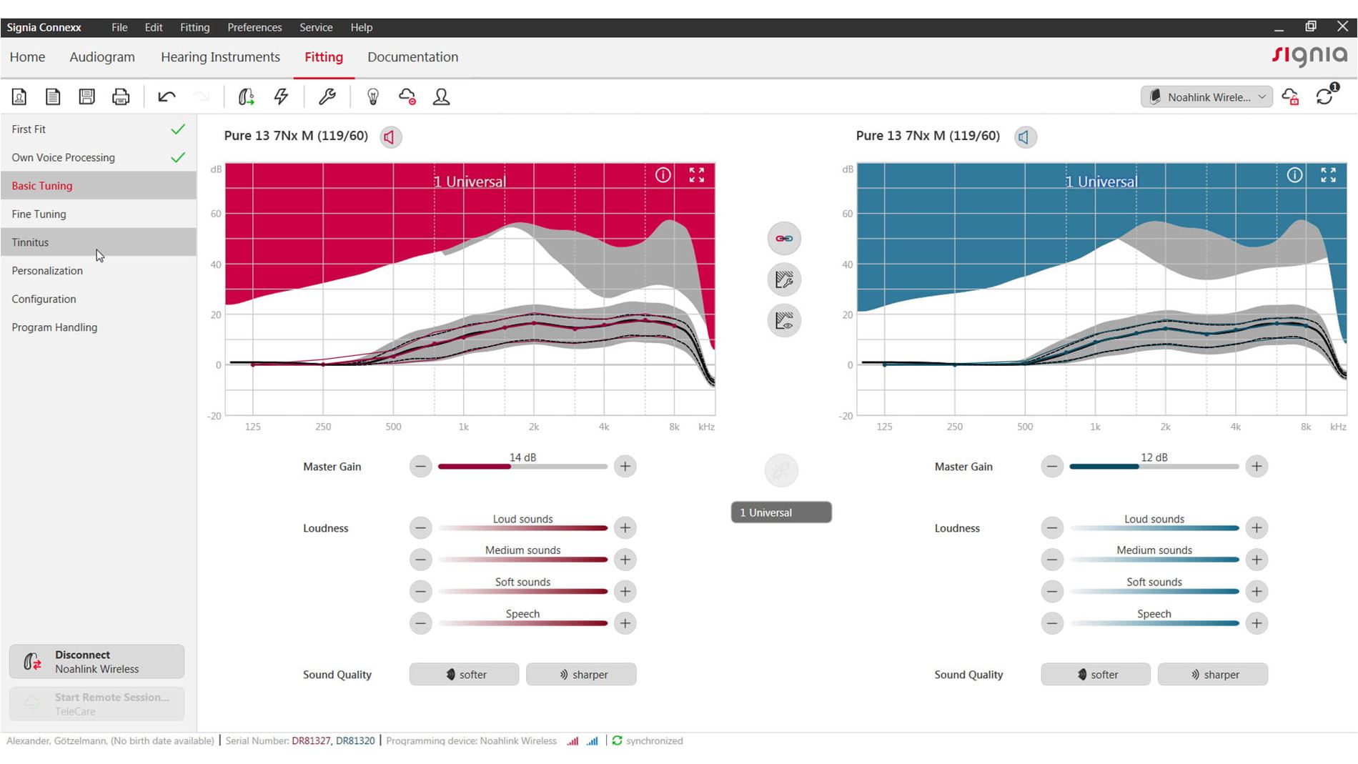 Connexx is the perfect fitting solution for Signia hearing aids ...