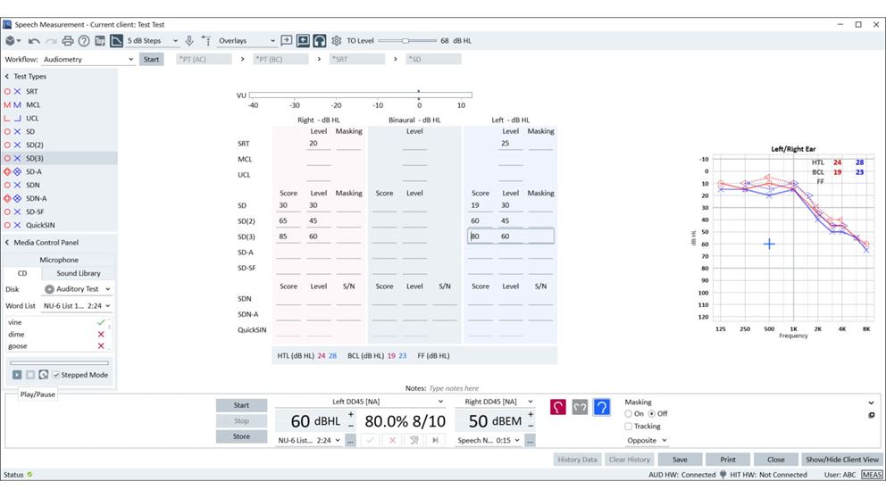 Portable audiometer for pure tone & speech audiometry – Unity 4