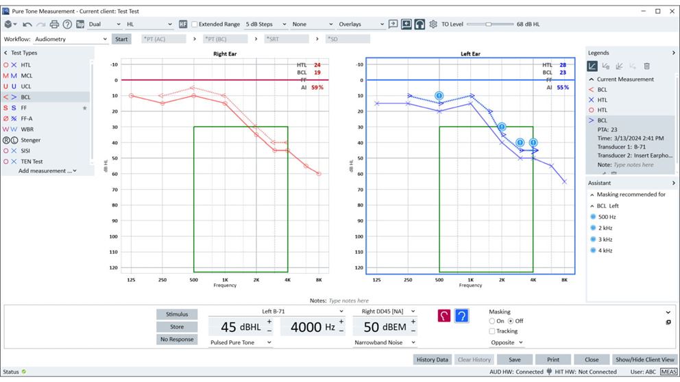 Portable audiometer for pure tone & speech audiometry – Unity 4