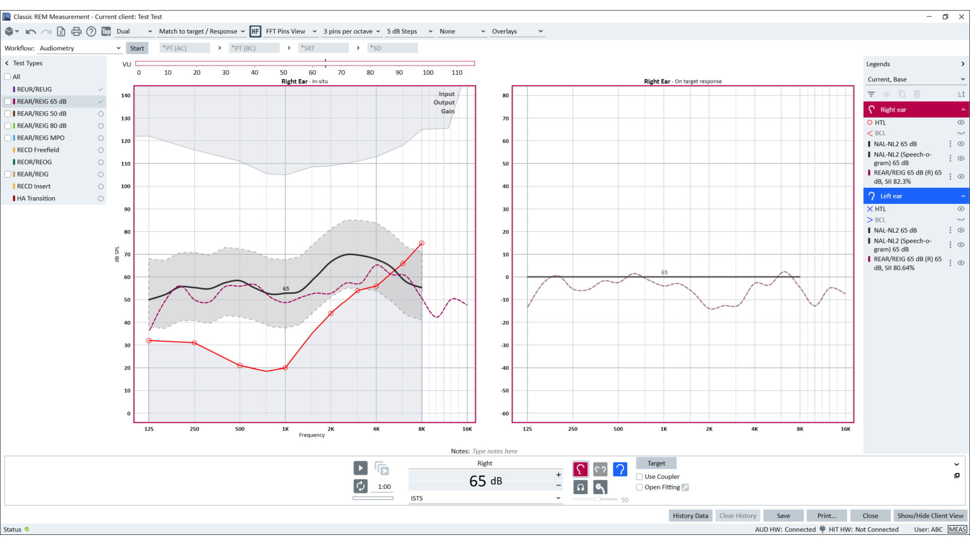 Real ear measurement (REM) equipment – Unity 4