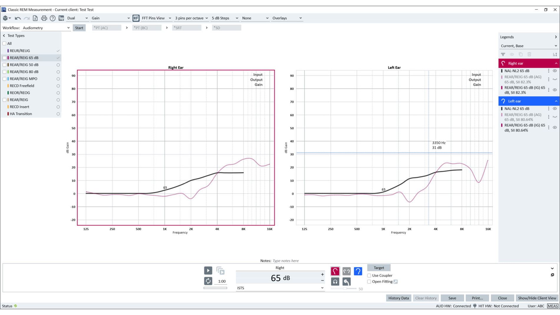 Real ear measurement (REM) equipment – Unity 4
