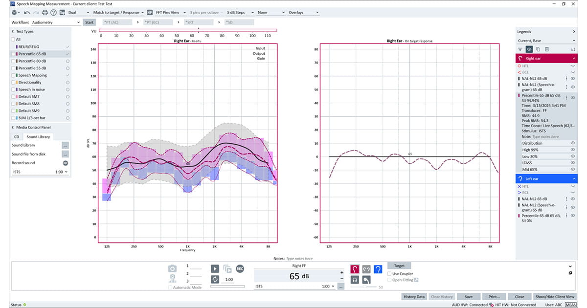 Speech mapping – Unity 4 | Signia Pro