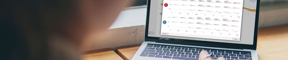 Connexx 9.9 - What's new in the Signia fitting software version ...