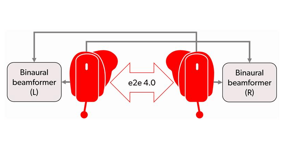 Directionality in Single-Microphone Hearing Aids: Speech Enhancement ...